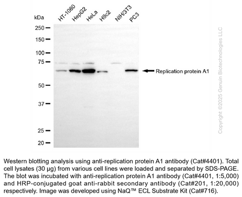 Anti-Replication protein A1 Rabbit Monoclonal Ab #4401 | GenuIN Biotech