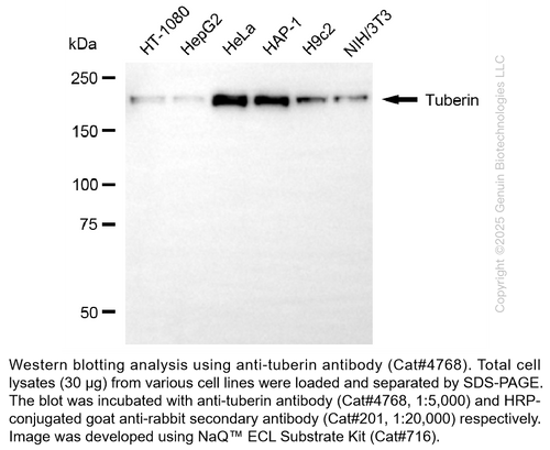 Anti-Tuberin Rabbit Monoclonal Ab #4768 | GenuIN Biotech