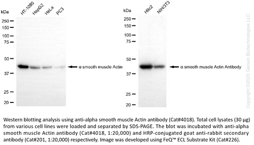 Anti-Alpha Smooth Muscle Actin Rabbit mAb #4018 | GenuIN Biotech