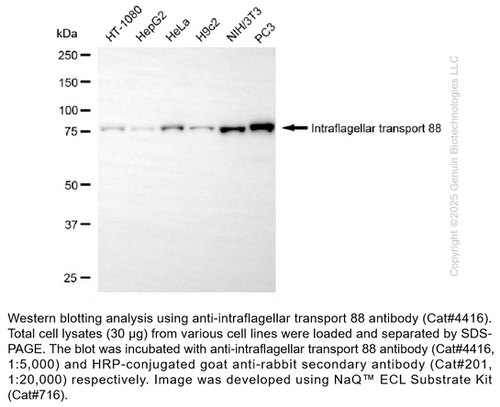 Anti-Intraflagellar transport 88 Rabbit Monoclonal Ab #4416 | GenuIN ...