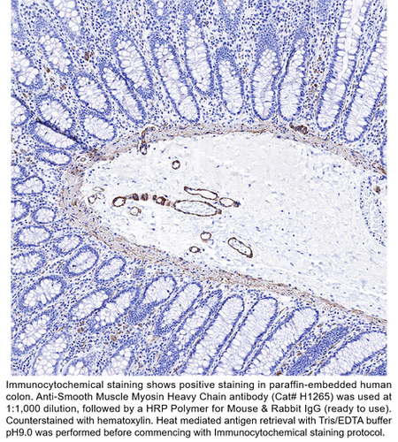 Anti-Smooth Muscle Myosin Heavy Chain Rabbit Monoclonal Ab #H1265 ...