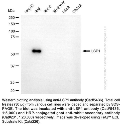 Anti-LSP1 Rabbit mAb #5436 | GenuIN Biotech