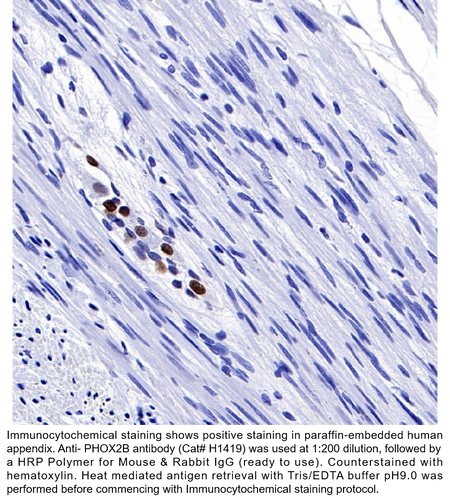 Anti-PHOX2B Rabbit Monoclonal Ab #H1419 | GenuIN Biotech