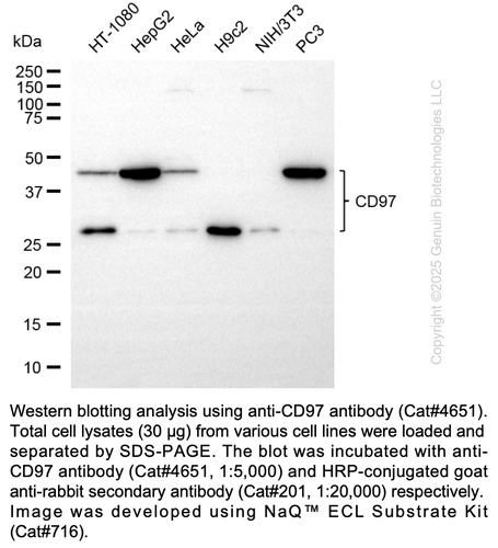 Anti-CD97 Rabbit Monoclonal Ab #4651 | GenuIN Biotech