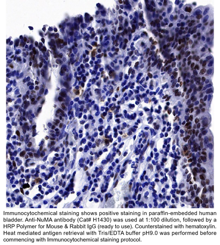 Anti-NuMA Rabbit Monoclonal Ab #H1430 | GenuIN Biotech