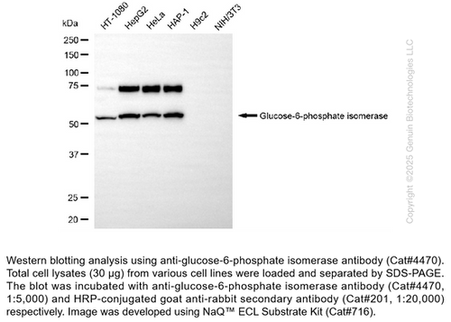 Anti-Glucose 6 phosphate isomerase Rabbit Monoclonal Ab #4470 | GenuIN ...
