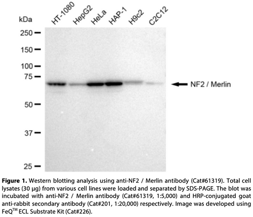 KD-Validated Anti-NF2 / Merlin Rabbit mAb#61319 | GenuIN Biotech