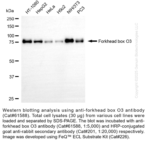 KD-Validated Anti-Forkhead Box O3 Rabbit Monoclonal Ab #61588 | GenuIN ...
