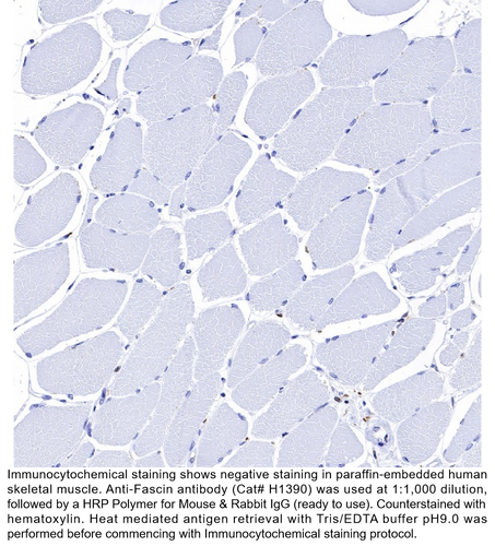 Anti-Fascin Rabbit Monoclonal Ab #H1390 | GenuIN Biotech