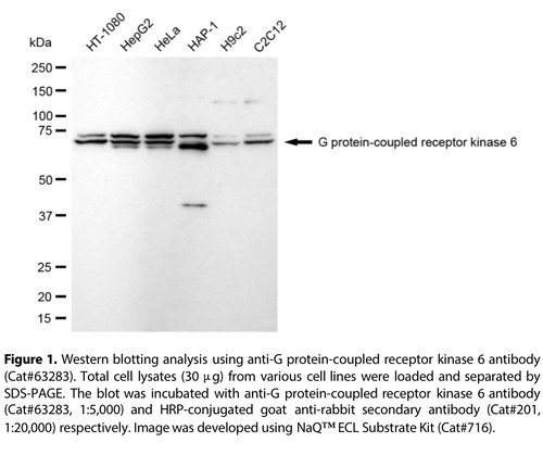 KD-Validated Anti-G Protein-Coupled Receptor Kinase 6 Rabbit Monoclonal ...