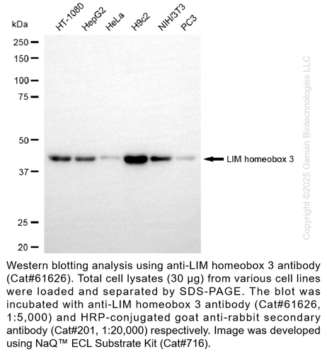 KD-Validated Anti-LIM Homeobox 3 Rabbit Monoclonal Ab #61626 | GenuIN ...