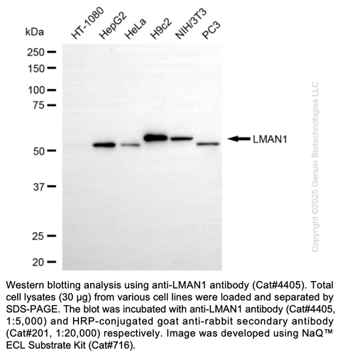 Anti-LMAN1 Rabbit Monoclonal Ab #4405 | GenuIN Biotech