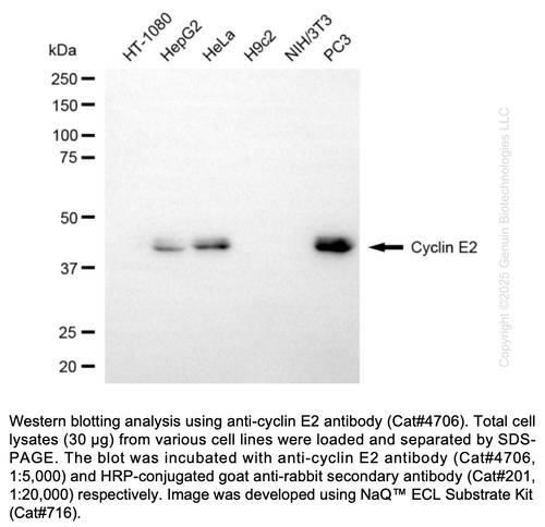 Anti-Cyclin E2 Rabbit Monoclonal Ab #4706 | GenuIN Biotech