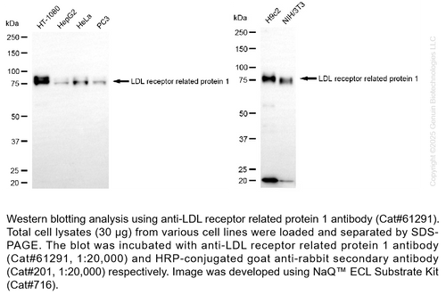 KD-Validated Anti-LDL receptor related protein 1 Rabbit mAb #61291 ...
