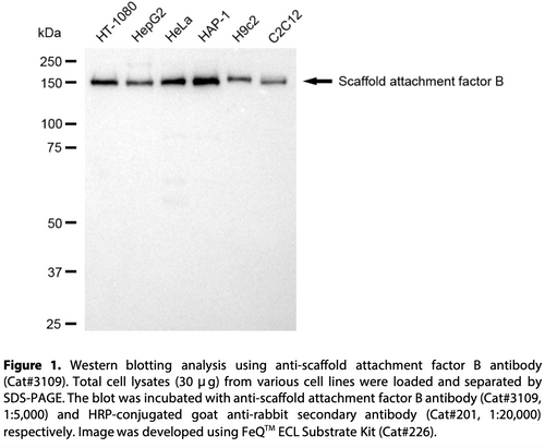 Anti-Scaffold Attachment Factor B Rabbit Monoclonal Ab#3109 | GenuIN ...