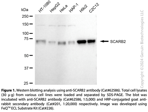 KD-Validated Anti-SCARB2 Rabbit Monoclonal Ab#62586 | GenuIN Biotech