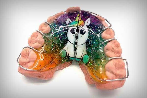 ¿Qué es y para qué sirve un expansor palatino para niños?