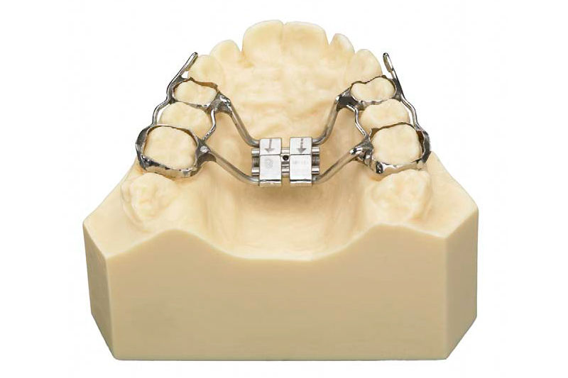 ¿Qué es y para qué sirve un expansor palatino para niños?