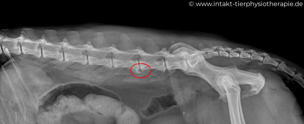 Eine häufig auftretende Erkrankung - DIE SPONDYLOSE