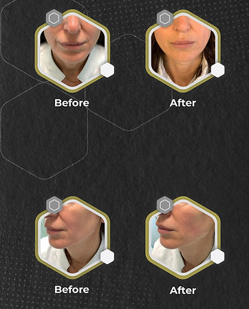 HOME | Karisma Official