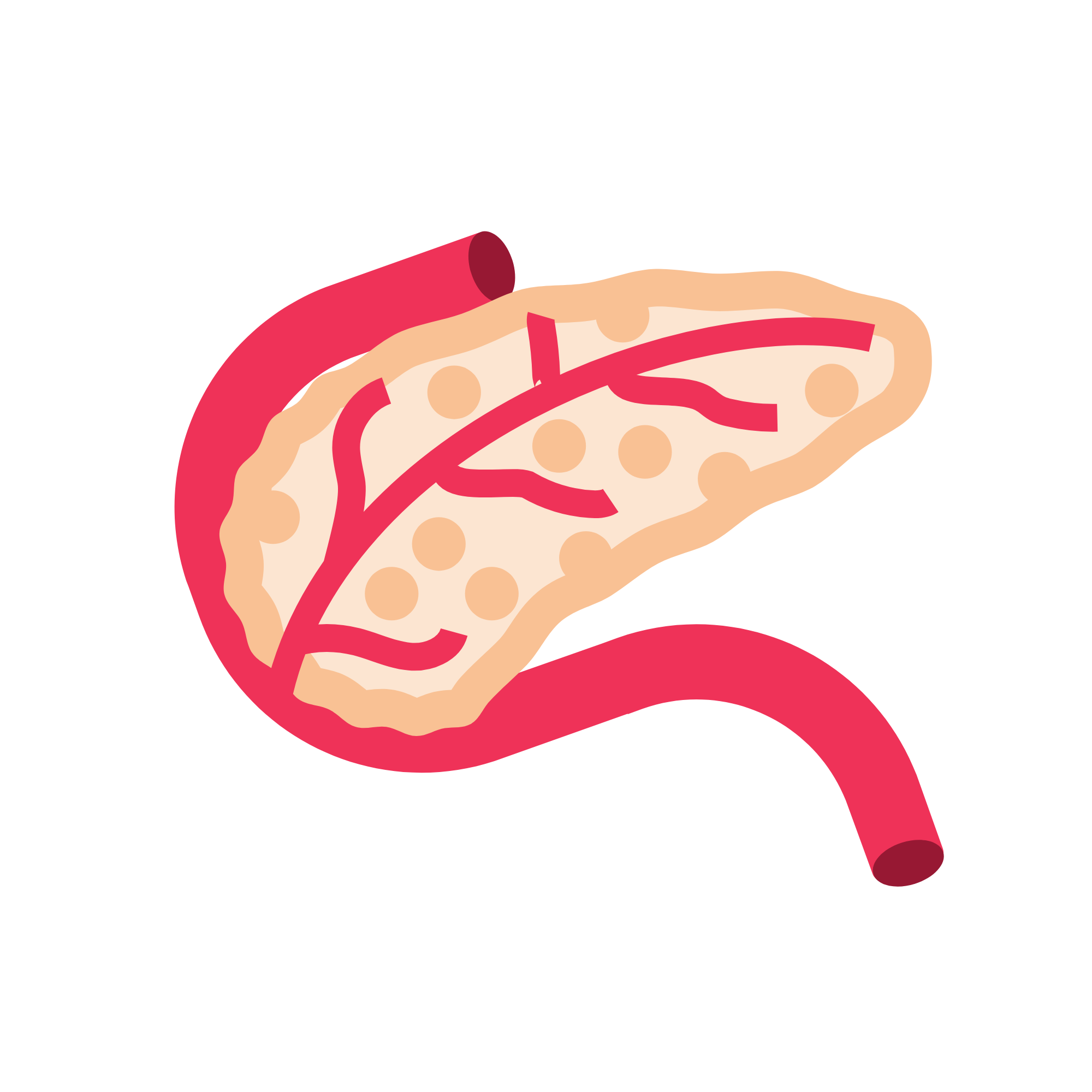 Pancreatic NET (PNET) | LACNETS