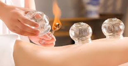 What Do TCM Cupping Marks and Colors Mean?