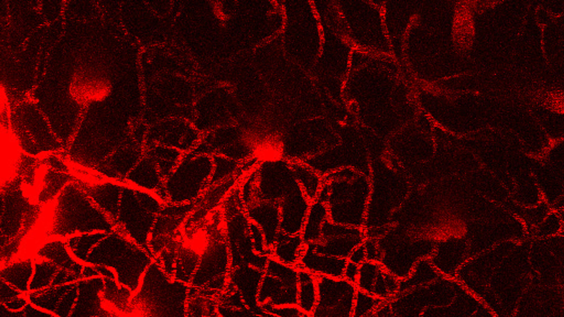 Two-Photon Microscopy System (RK-20) | FUS Instruments