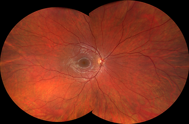 Eye exams | Carbon Valley Eye