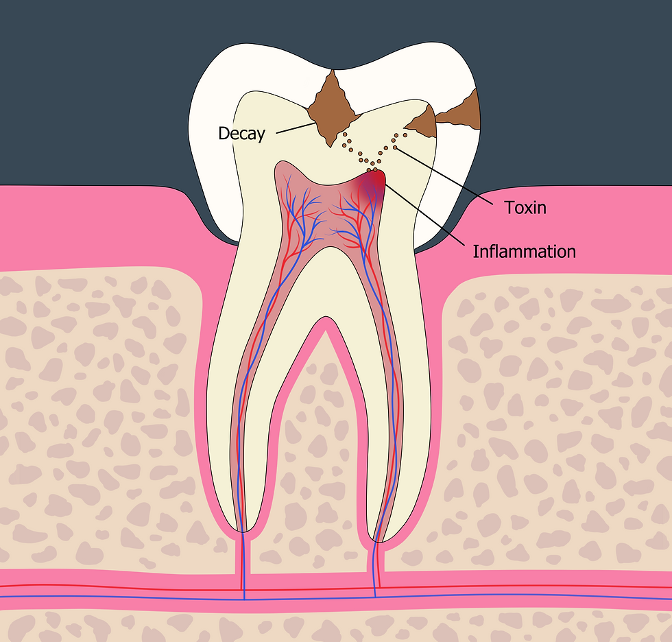The dynamic stages of pulpal and periapical diagnosis