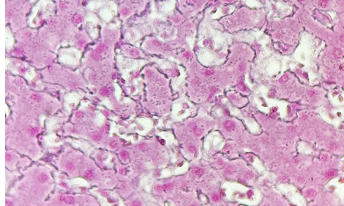 Reticular Fibers (Reticulin) Control Slides | Springside Sci.