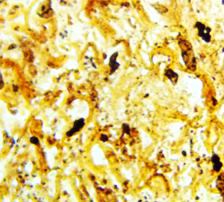 Spirochete Control Slides - Treponema pallidum | Springside Sci.