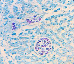 Fite Stain | Springside Sci.