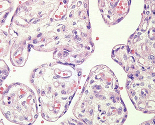 Human tissue-Placenta | Springside Sci.