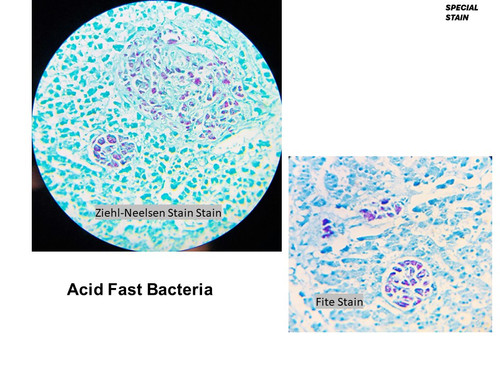 Acid Fast Bacteria /Fite Stain Control Slides | Springside Sci.