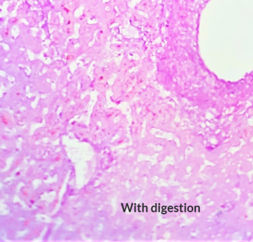 Periodic Acid Schiff with Digestion (PAS-D) Control Slides | Springside ...