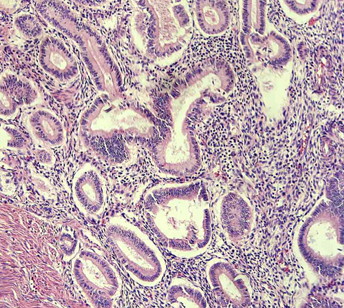 Human tissue- Uterus | Springside Sci.