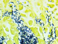 Gram staining Control Slides | Springside Sci.