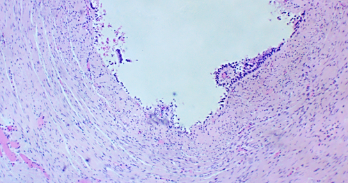 Human tissue- Fallopian tube | Springside Sci.
