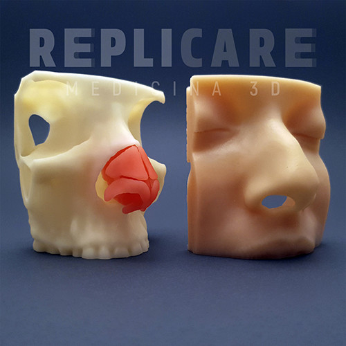 MAN (Modelo Anatômico de Nariz) | REPLICARE 3D