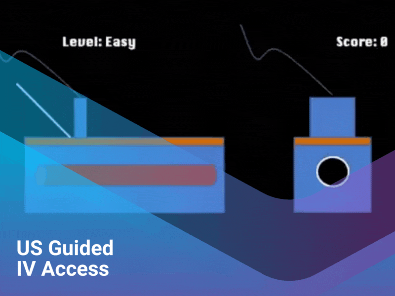 Ultrasound-Guided IV Cannulation