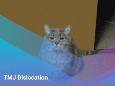 Temporomandibular Joint (TMJ) Dislocation