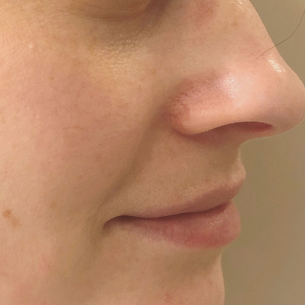 Episode 4: Not Your Average Facial Flushing