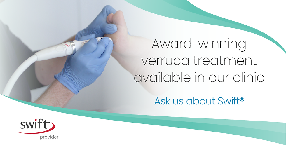 Swift Emblation microwave therapy for the treatment of warts & verruca ...