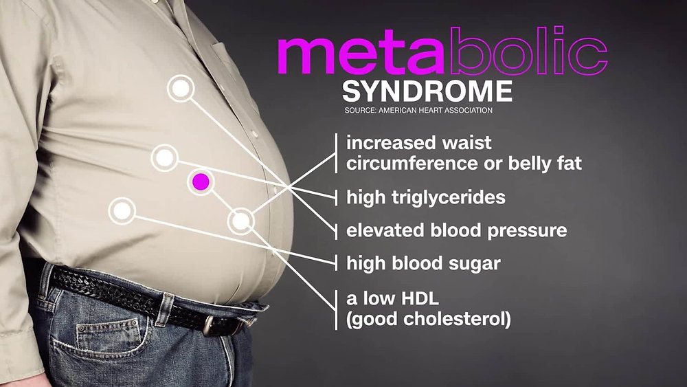 IMPORTANT FACTS WE NEED TO KNOW ABOUT METABOLIC SYNDROME