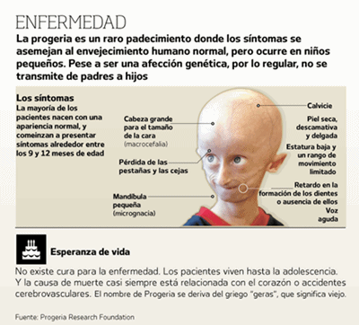 Síntomas | progeria-ocortes