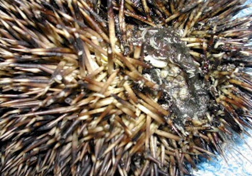 Myiasis (Fly Larvae On Hedgehogs)