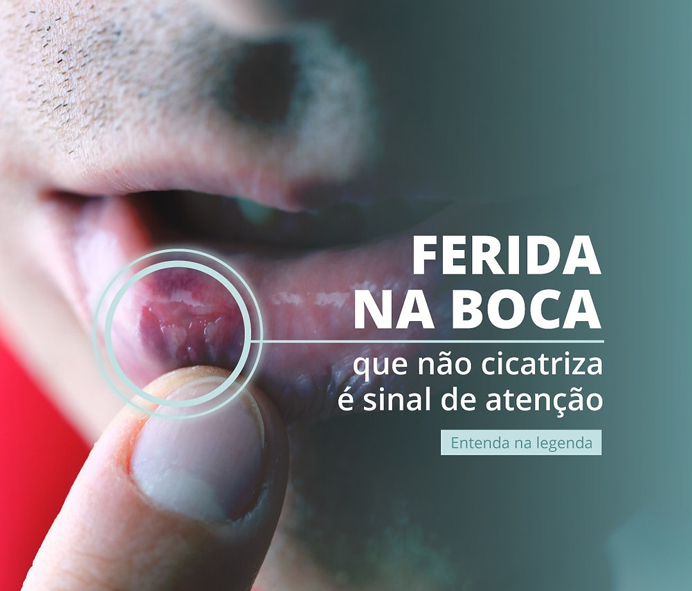 Tipos De Feridas Cirurgicas Tratamento Ferida Pós Cirúrgica