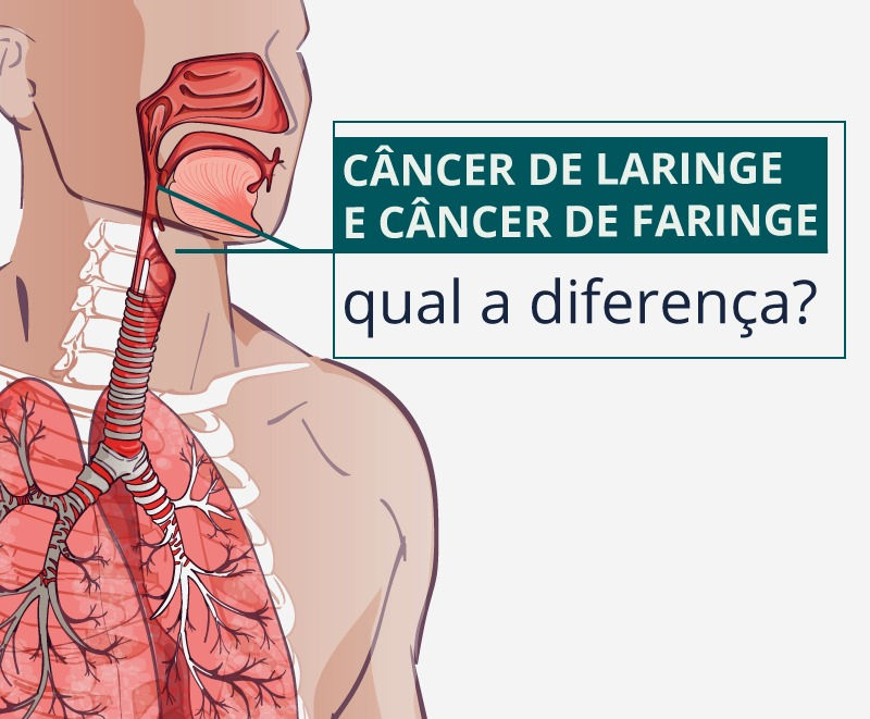 Diferenças entre Câncer de Faringe e Laringe