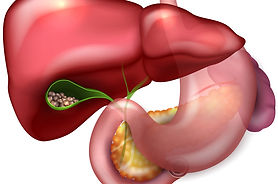 gallbladder stone operation