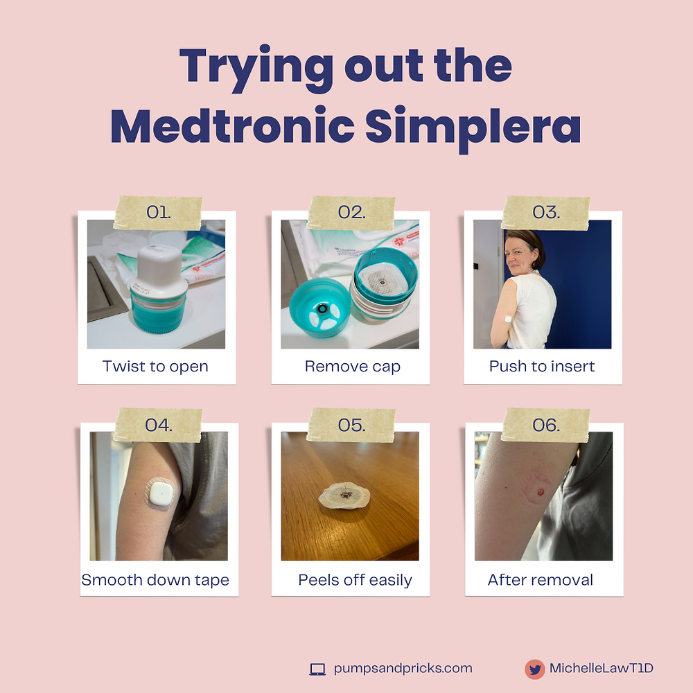 Trying out the Medtronic Simplera CGM